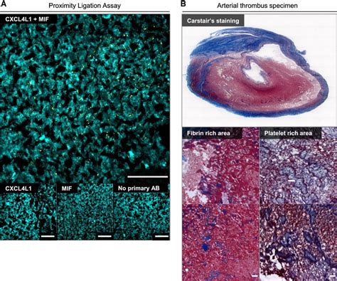 Proximity Ligation Assay Pla Indicates That Mif Cxcl4l1 Download