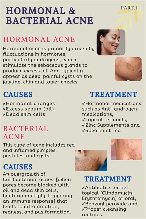 Best 13 Forehead Bumps What Causes Skin Congestion Bumps And Clogged