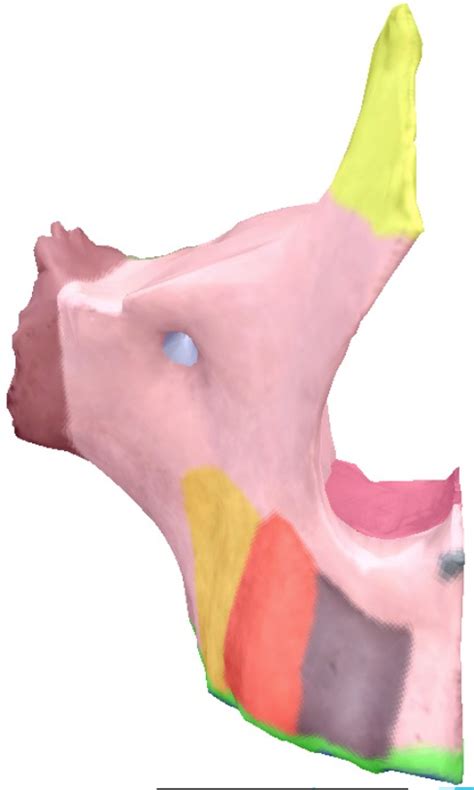 Diagram Of Anterior Features Of The Maxillary Bone Quizlet