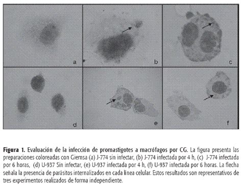 Estudio De La Infección De Leishmanias Del Complejo Viannia Mediante