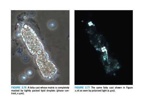 Urine Microscopy Ppt