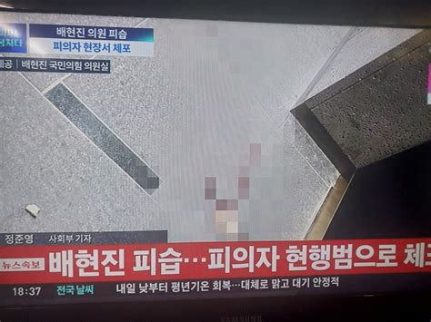 속보배현진 피습 현장 사진 공개 정치시사 에펨코리아