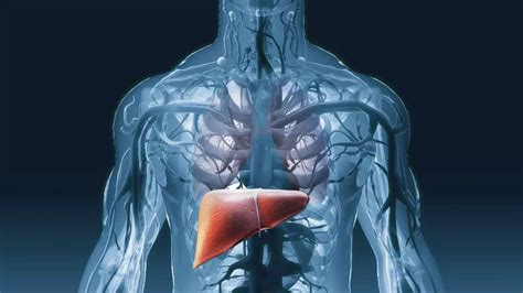 Liver Cirrhosis Subtle Signs And Symptoms You Should Know