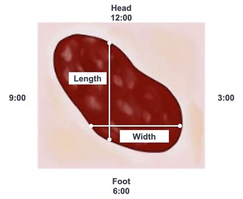 How To Assess A Patient With Chronic Wounds