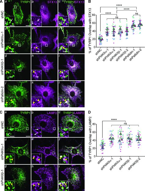 Tyrp1 Is Mislocalized To Early Endosomes And Late Endosomeslysosomes