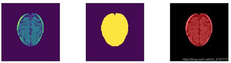 【医疗影像处理】erosion And Dilation Of Medical Images Masks Using Scipy Ndimage In Python 对医学3d分割图像进行腐蚀