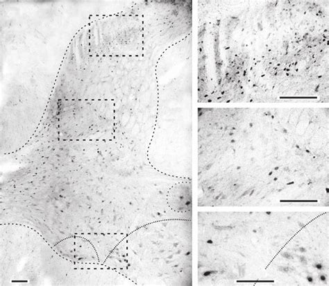 Photomicrographs Of Fos Immunoreactive Fos Ir Neurons In A Slice Of