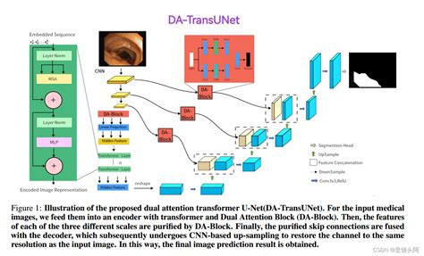 20、清华、杭州医学院等提出：da Transunet，超越tranunet，深度医学图像分割框架的 皇帝的新装 Csdn博客