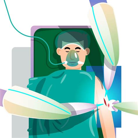 A Robotic Arm Performs Surgery On A Patient Small Incision Robotic