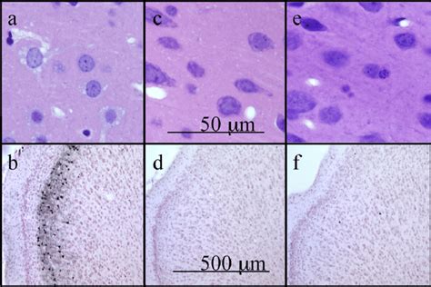 Representative Histological Sections Of The Retrosplenial Cortex From Download Scientific