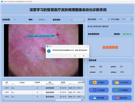 基于yolov8深度学习的智慧医疗皮肤病理图像自动化诊断系统pyqt5界面数据集训练代码 中猿创新 7zcode