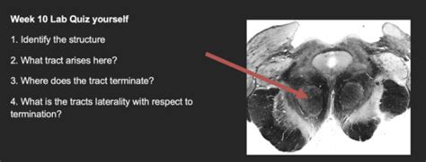 Motor Pathways Lab 10 17 Flashcards Quizlet