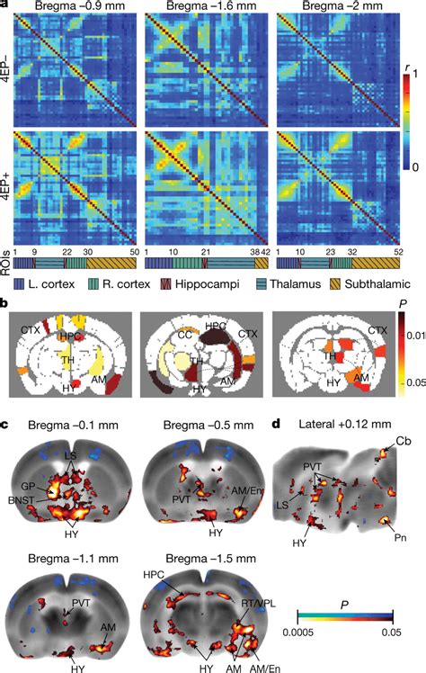 Functional Brain Connectivity And Regional Activation Is Altered In