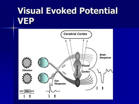 Ppt Visual Electrodiagnostic Testing 8 Powerpoint Presentation Free Download Id 1800262