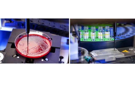 Copans Wasplab™ Bringing Total Laboratory Automation To The Microbiology Lab Medical Supply