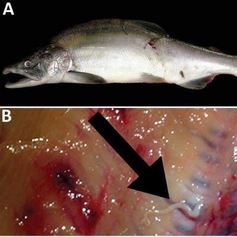 Asian Tapeworm Found In Alaskan Salmon
