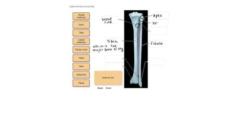 Solved Ic 4 00 54 54 Label The Structures Of The Bones Trochlear