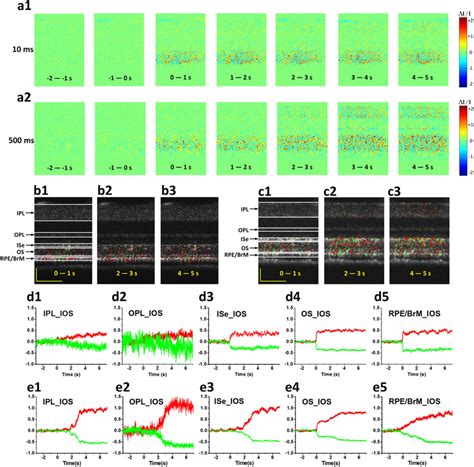 Spatiotemporal Characterization Of Functional Oct Ios Imaging With Download Scientific Diagram