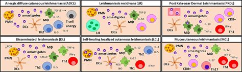 Diffuse Cutaneous Leishmaniasis
