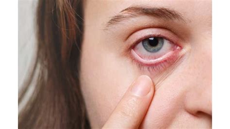 Eye Power Correction Treatment