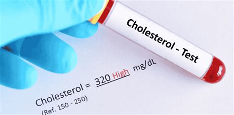 What Does A Cholesterol Test Reveal About Your Heart Health
