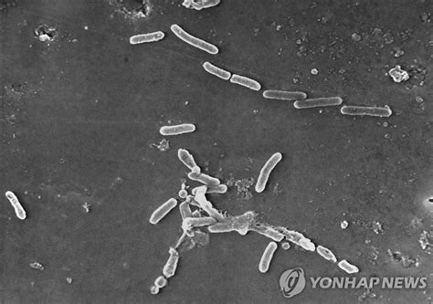 기후변화 탓 항생제 안 통하는 슈퍼박테리아 확산 연합뉴스