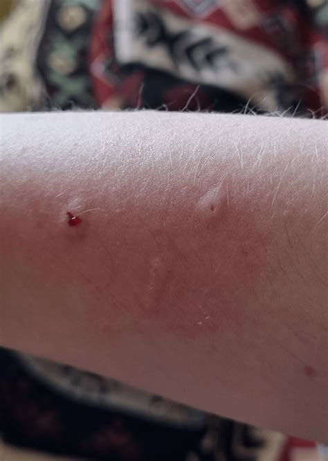 This Cat Bite Looks Like A Face Rnotinteresting