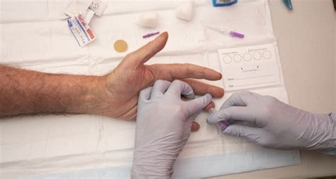Game Changing Hepatitis C Testing Program Awarded M Inside UNSW