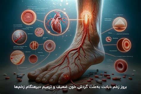 زخم دیابت؛ بررسی عوامل، نحوه پیشگیری و علائم آن آدوراطب