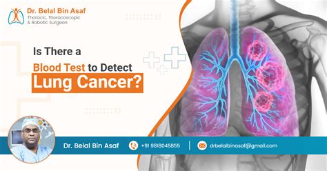 How Accurate Is Ct Scan For Lung Cancer