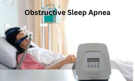 Single Lead Ecg And Cpap Titration May Help Manage Sleep Apnea At Home