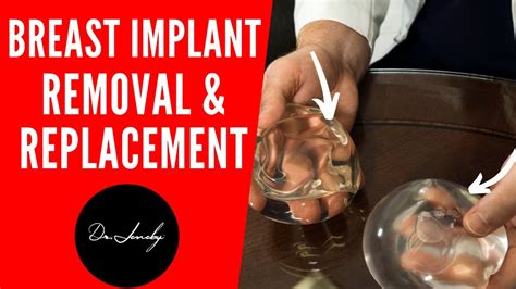 Breast Implant Removal And Replacement W Silicone Implant And