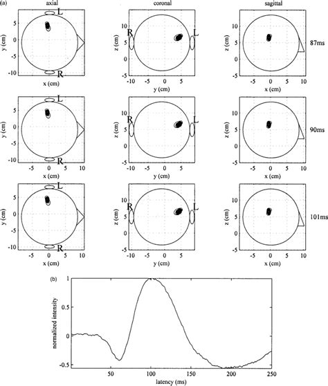 Results Of Applying The Eigenspace Based Beamformer To The Data Shown