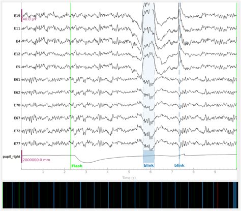Working With Eye Tracker Data In Mne Python — Mne 1101 Documentation