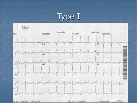 Ppt Atrial Flutter Powerpoint Presentation Free Download Id 5698316