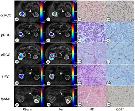 Renal Dynamic Imaging