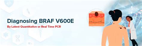 What Is Hla B27 Pcr Test Uses Procedure Precautions And Test Price