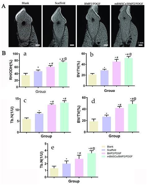 A Buccal Lingual Micro Ct Reconstruction 8 Weeks After Surgery B Download Scientific