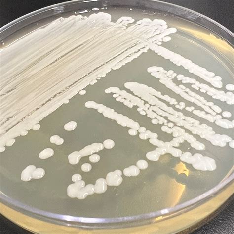 Staphylococcus Haemolyticus Microchem Laboratory