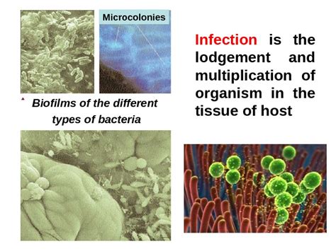 Infection And Infectious Process 1 Infection Classification Of