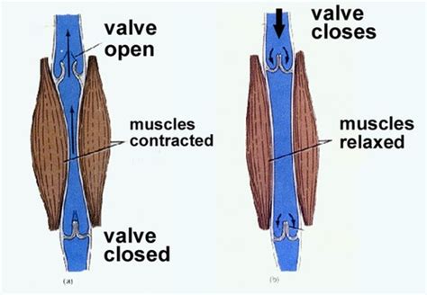 Ch 22 Venous Hemodynamics 23 Venous Pathology Signs And Symptoms Flashcards Quizlet