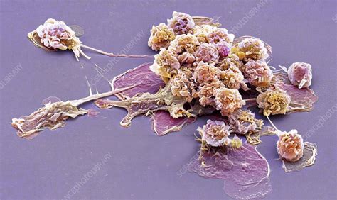 Activated Granulocytes Sem Stock Image C060 3129 Science Photo Library