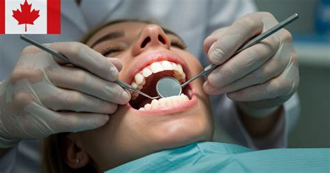 Which Dental Services Are Covered By Cdcp Full Guide