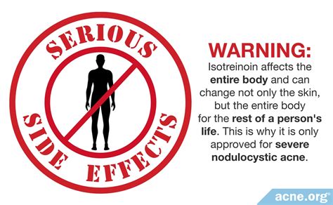 Accutane Isotretinoin How It Works Side Effects And Reviews