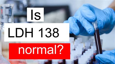 Is Ldh 138 Normal High Or Low What Does Lactate Dehydrogenase Level 138 Mean