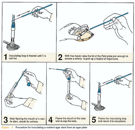 Aseptic Technique Exercise Flashcards Quizlet