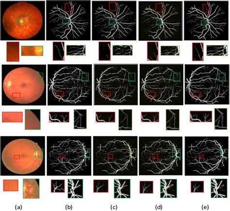 the results and enlarged versions of segmentation of different download scientific diagram