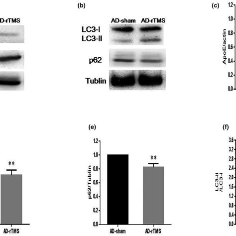 Rtms Rescues Ad‐related Lesions In Appps1 Mice Hippocampal Protein