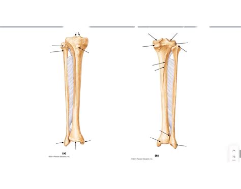 Fibia And Tibia Quiz Fibia And Tibia Quiz