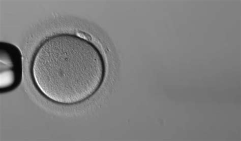 Samrat Kundu On Linkedin Sperm Injecting Robot